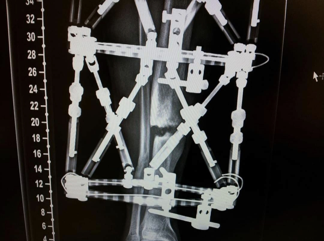 Alex Smith, an injured soldier and a friendship born from a shared ...